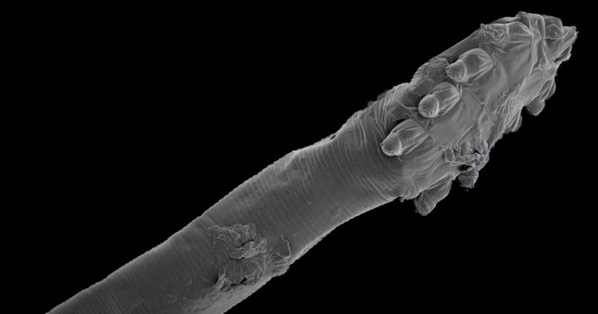 Demodex los Secretos Genéticos de los Ácaros de la Piel: Más que ...