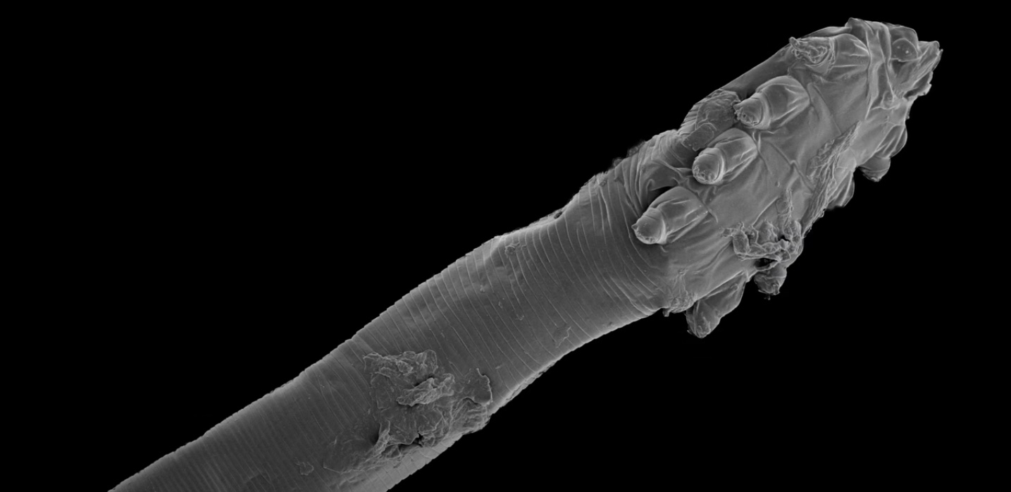 Demodex los Secretos Genéticos de los Ácaros de la Piel: Más que ...